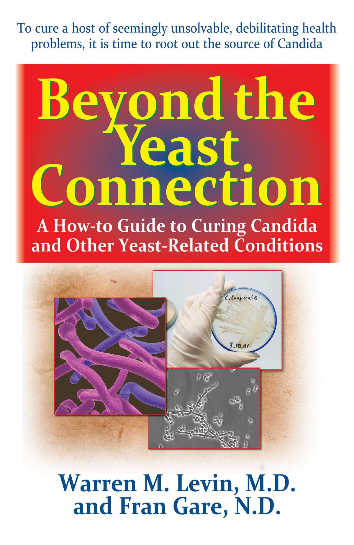 Beyond the Yeast Connection: A How-To Guide to Curing Candida and Othe ...